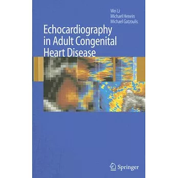 博客來-Echocardiography in Adult Congenital Heart Disease