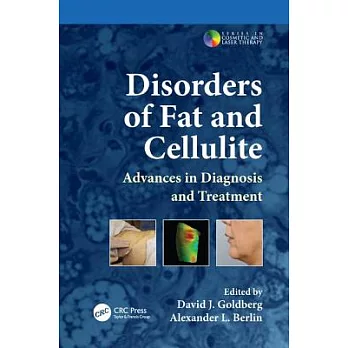 博客來-Disorders of Fat and Cellulite: Advances in Diagnosis and Treatment