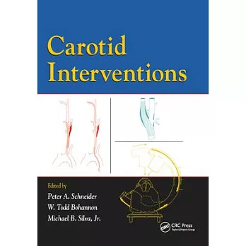 博客來-Carotid Interventions