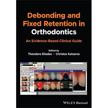博客來-Debonding and Fixed Retention in Orthodontics: An Evidence-Based ...