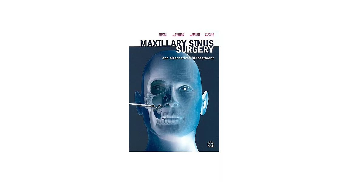 博客來-Maxillary Sinus Surgery and Alternatives in Treatment
