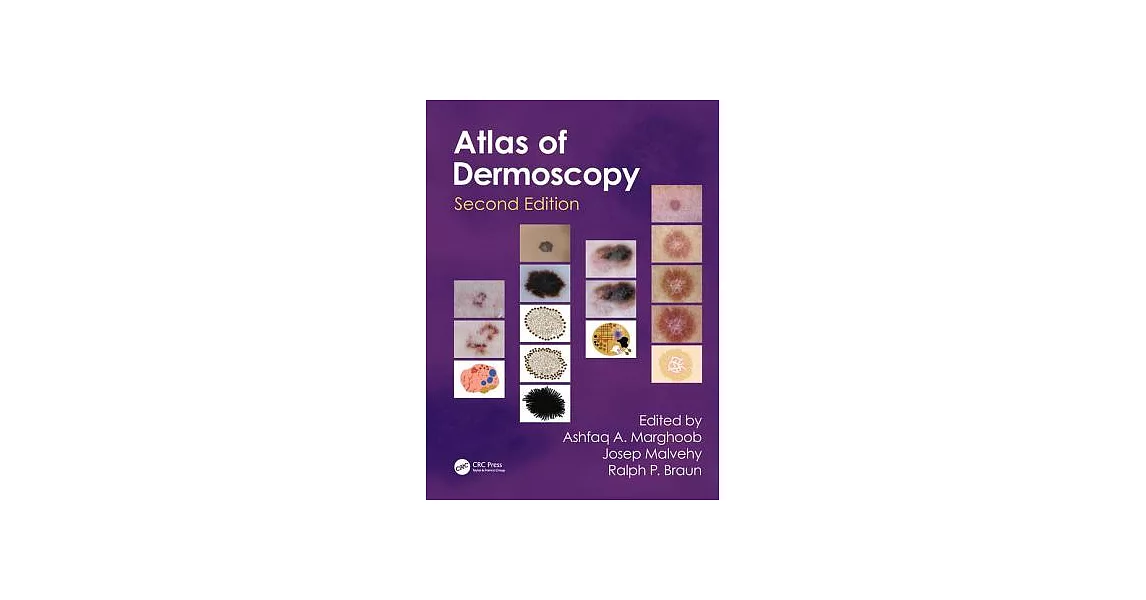 博客來-An Atlas of Dermoscopy