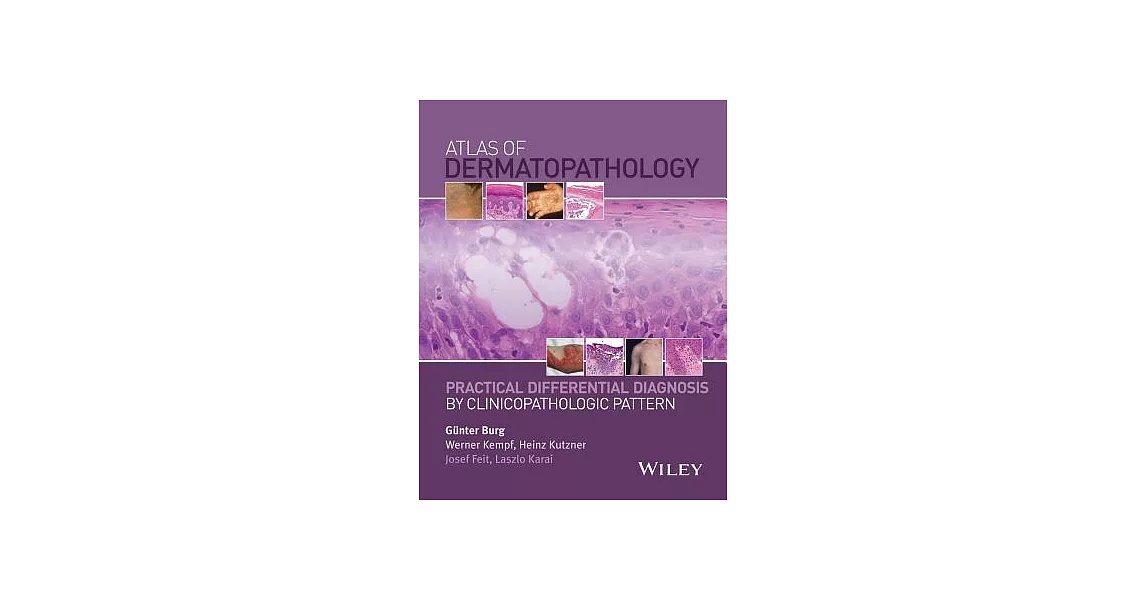 博客來-Atlas of Dermatopathology: Practical Differential Diagnosis by Clinicopathologic Pattern