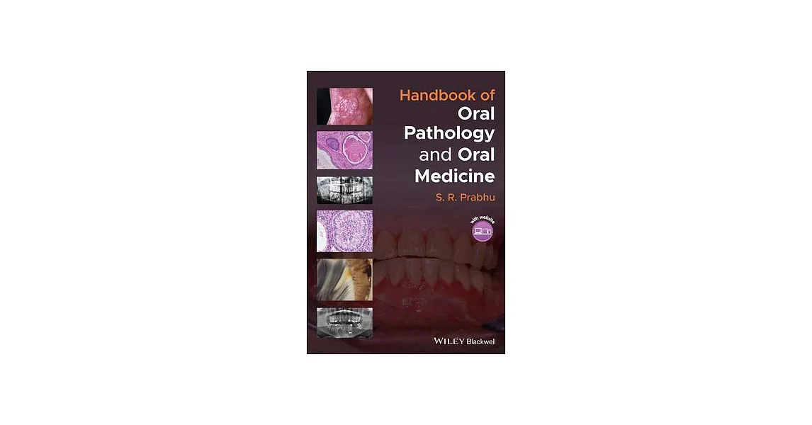 博客來-Handbook of Oral Pathology and Oral Medicine